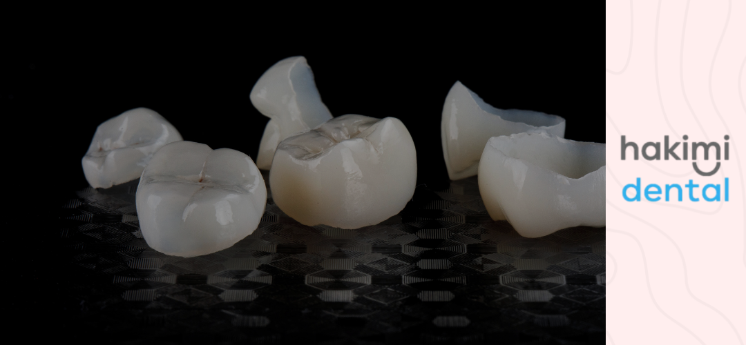 Dental Crowns: Types, Cost & Procedure Explained