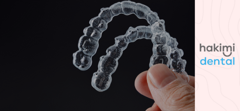 How Long Does Invisalign Take?